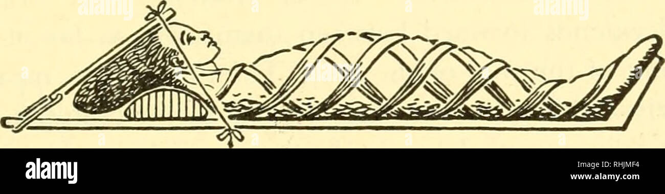 Lambdoidal suture hi-res stock photography and images - Alamy