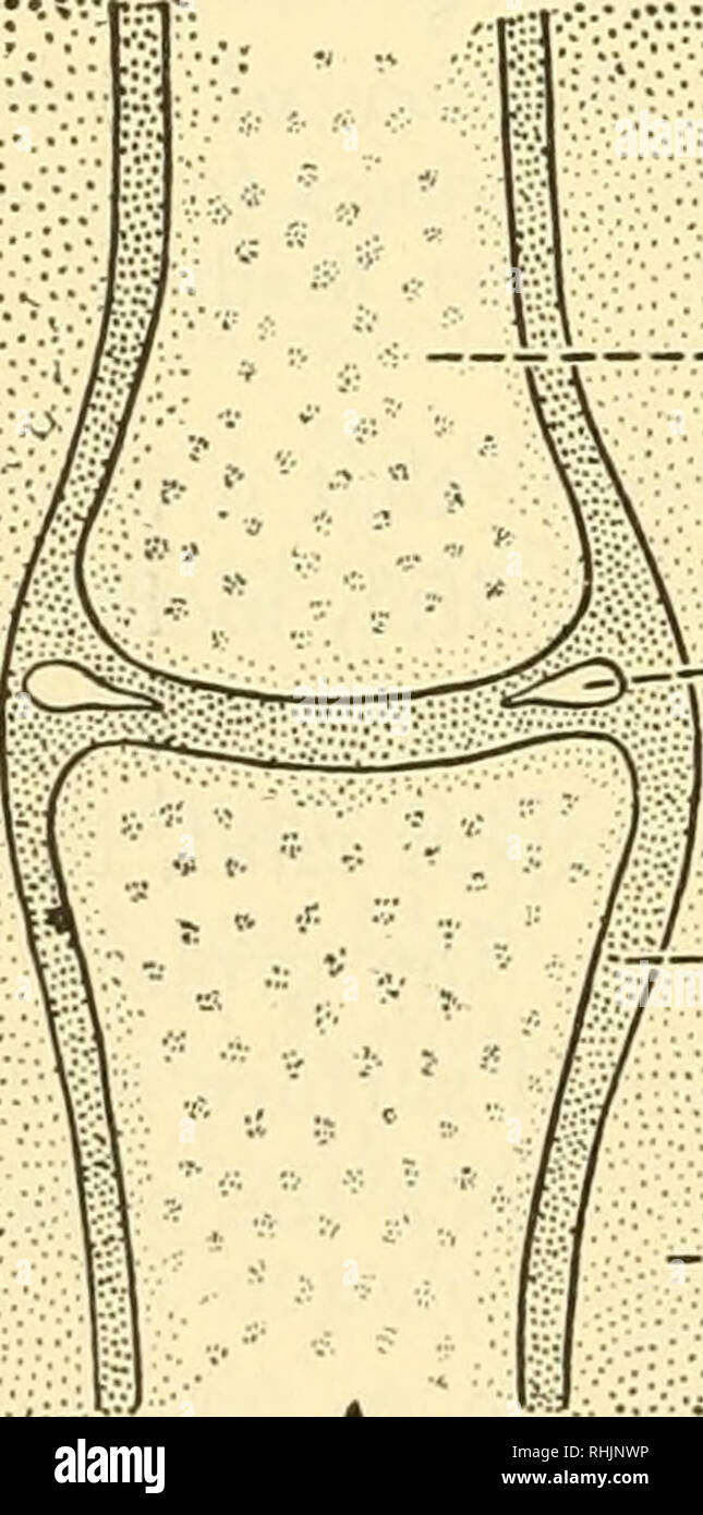 Squamosal Suture