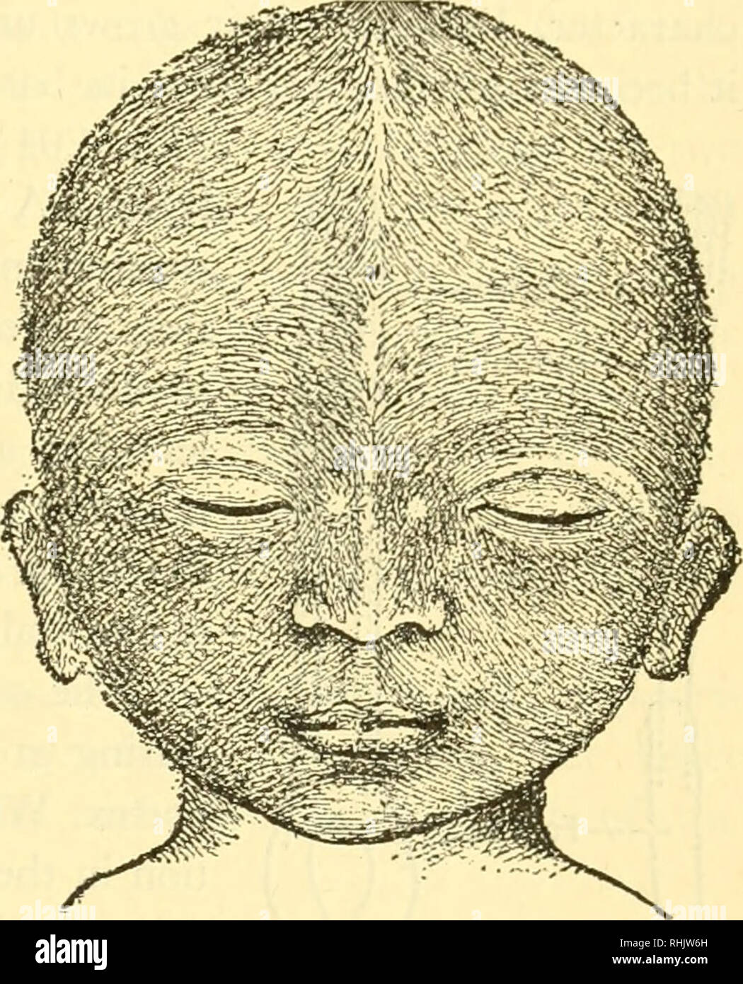 Lanugo man hi-res stock photography and images - Alamy