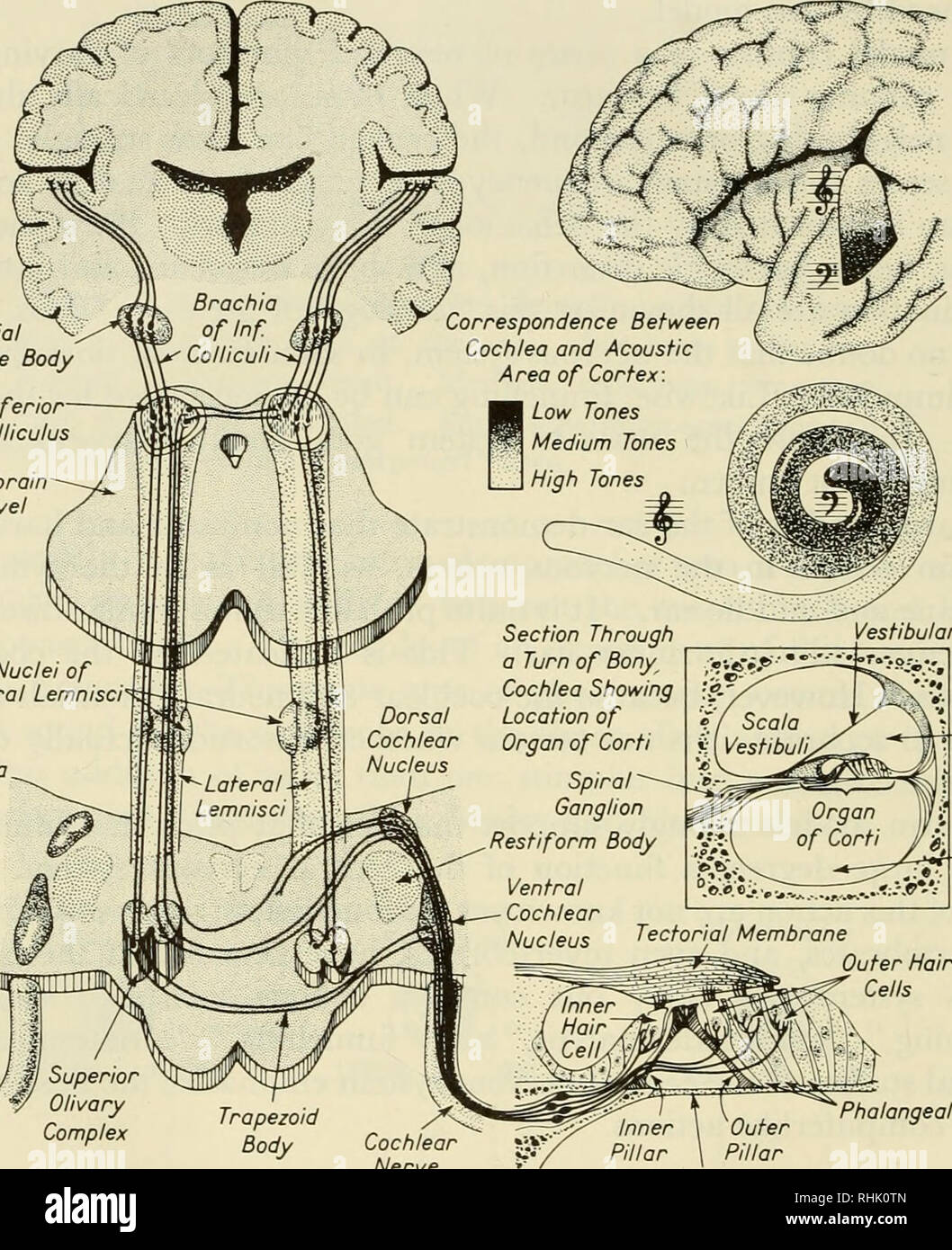 Cochlear Nerve Pathway