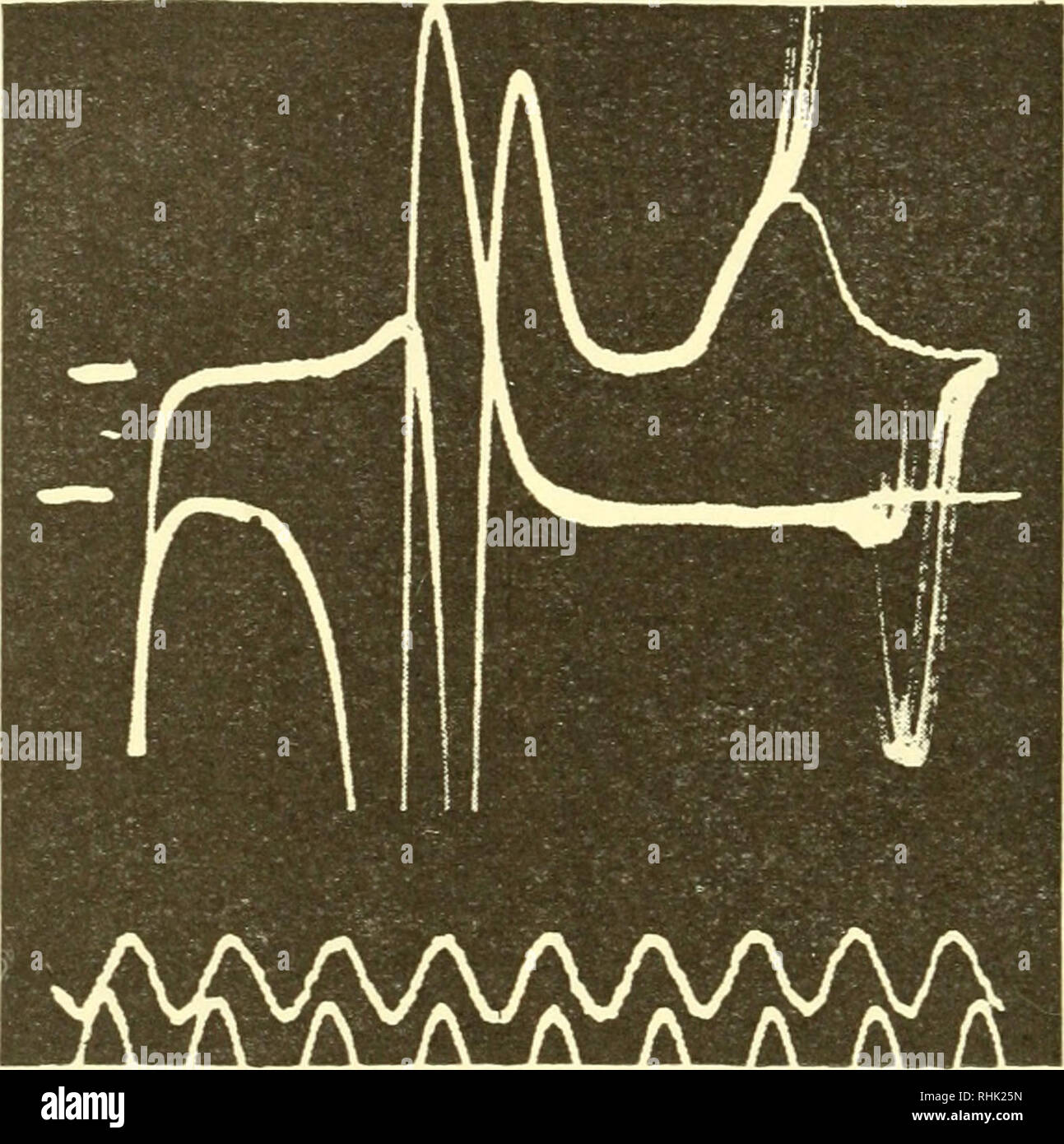 Giant axon hi-res stock photography and images - Alamy