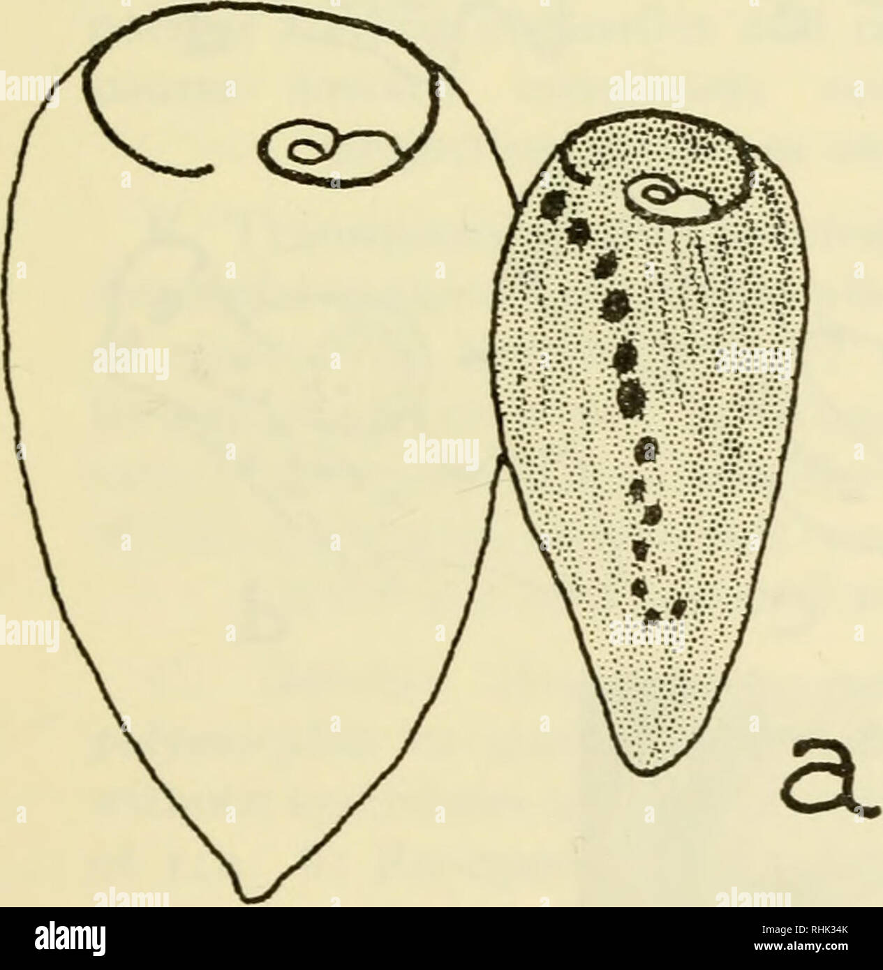 Stentor Coeruleus Labeled