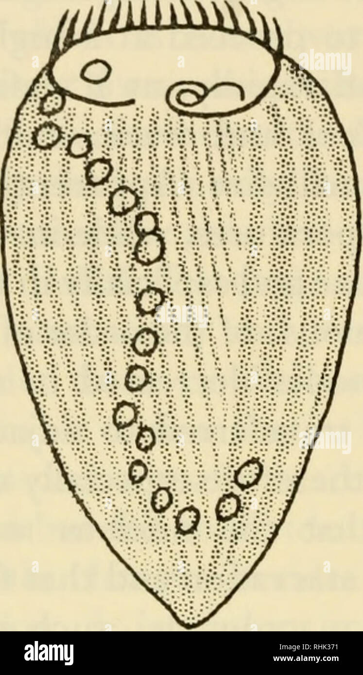 Stentor Coeruleus Labeled
