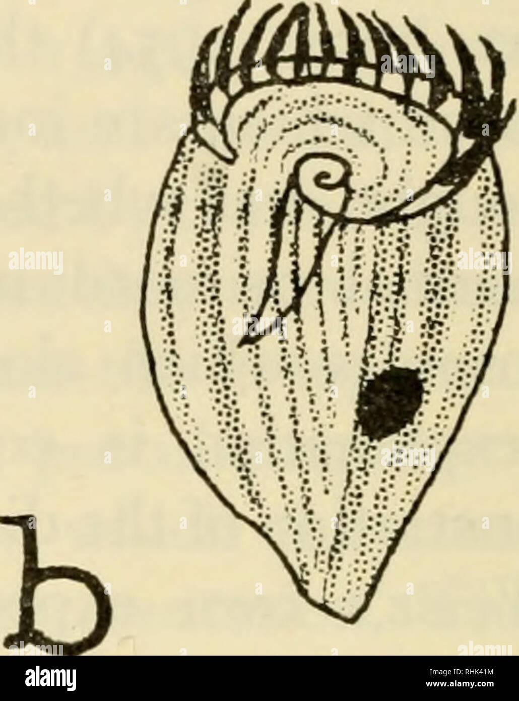 Ciliates Stentor