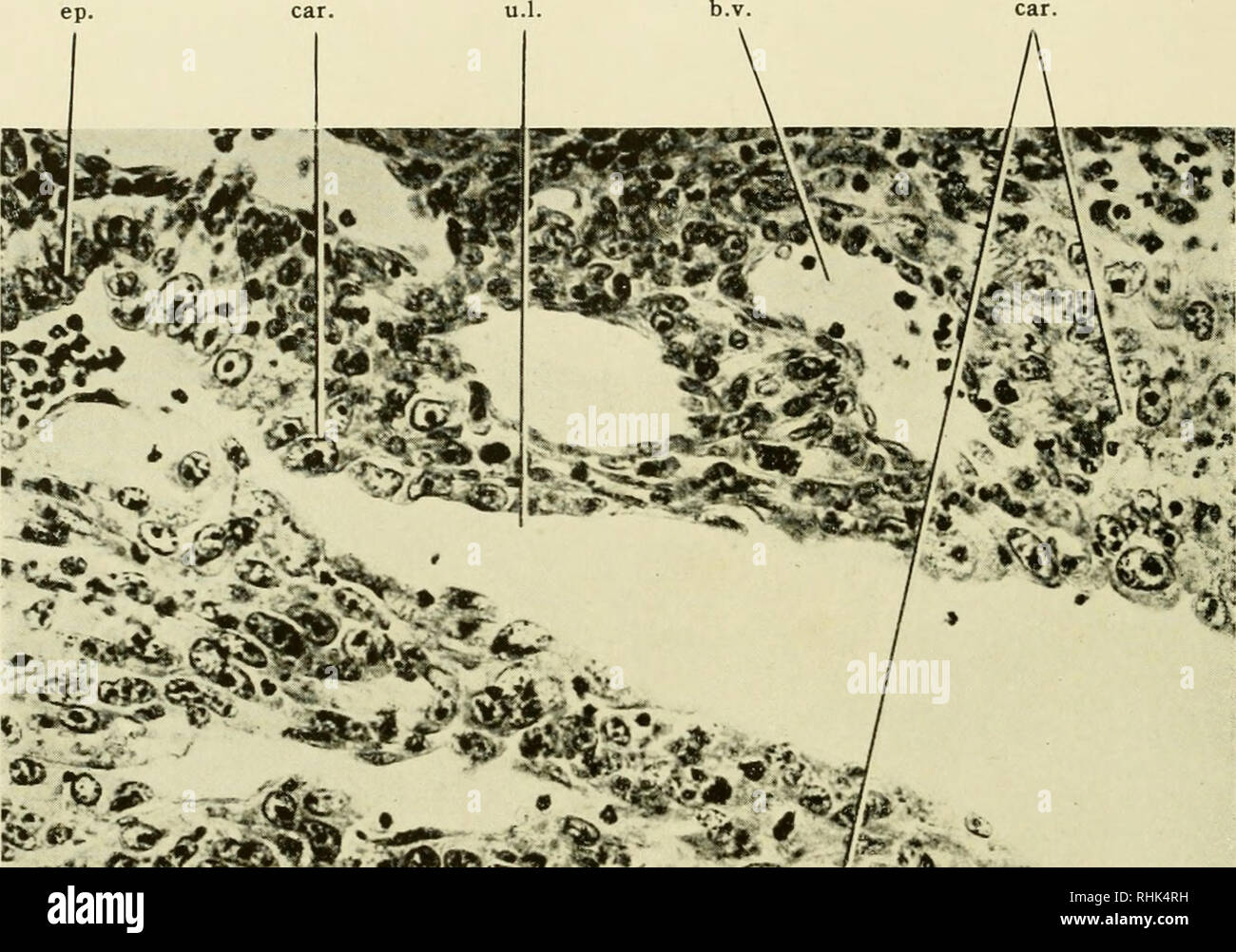 Coarse chromatin hi-res stock photography and images - Alamy