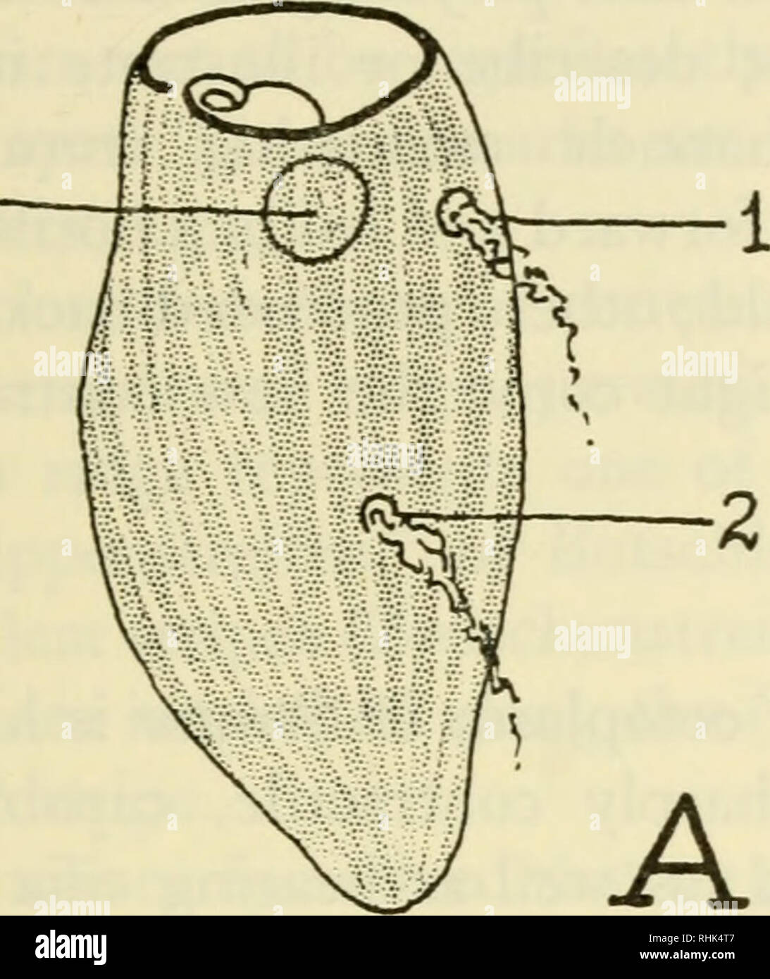 Stentor Coeruleus Labeled