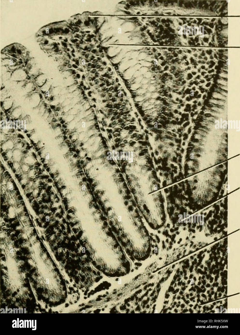 Muscularis Mucosae High Resolution Stock Photography and Images - Alamy