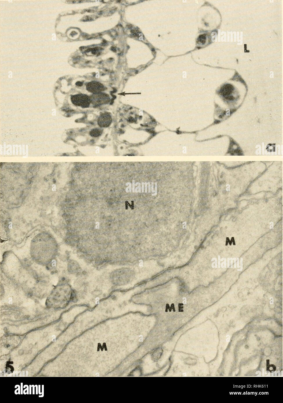 Hydra Cnidaria Cross Section