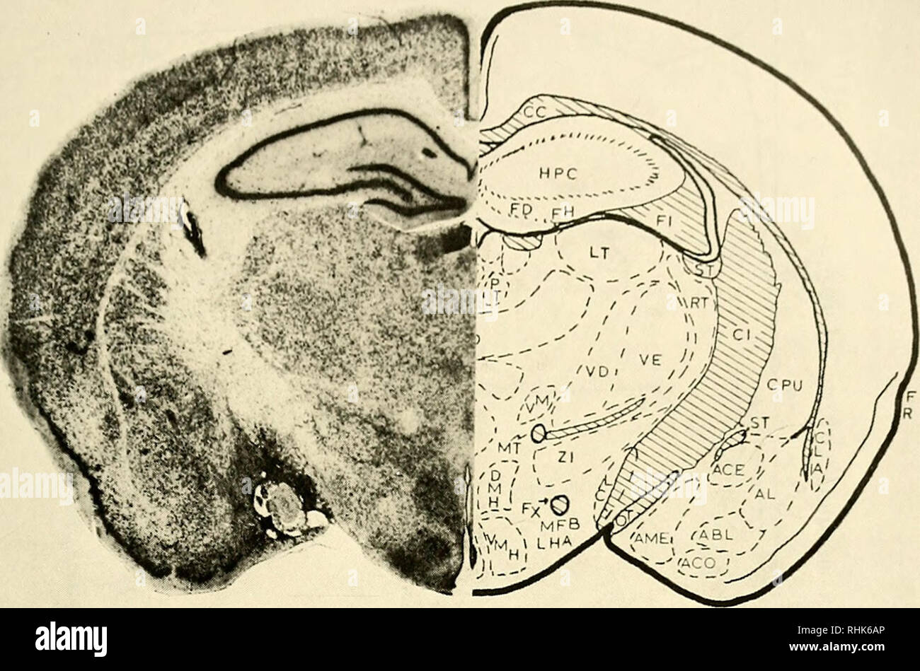 Amygdaloid nucleus hi-res stock photography and images - Alamy