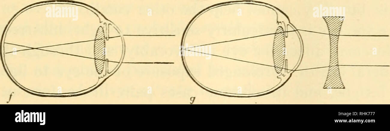 Far Sightedness Stock Photos & Far Sightedness Stock Images - Alamy