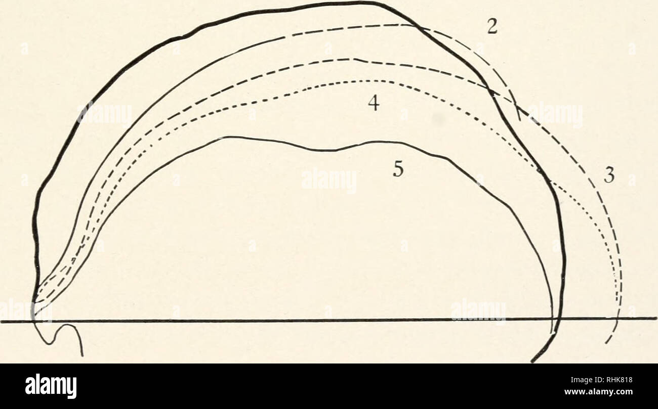 Cranial capacity hi-res stock photography and images - Alamy