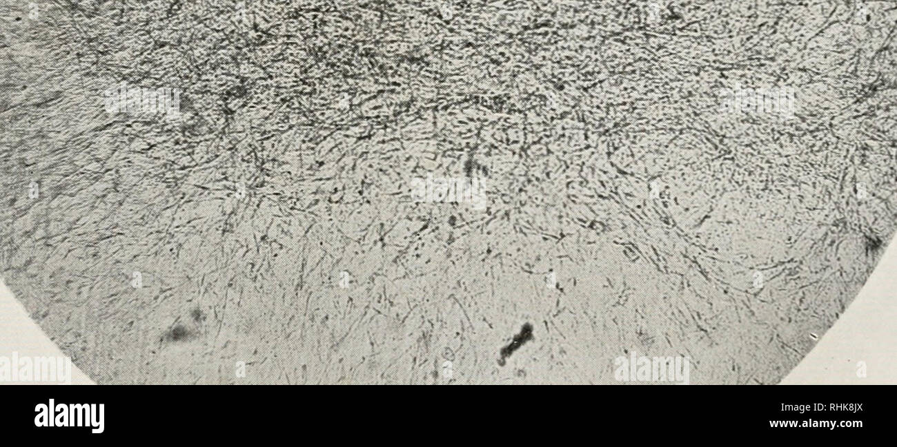 Human connective tissue in culture hi-res stock photography and images ...