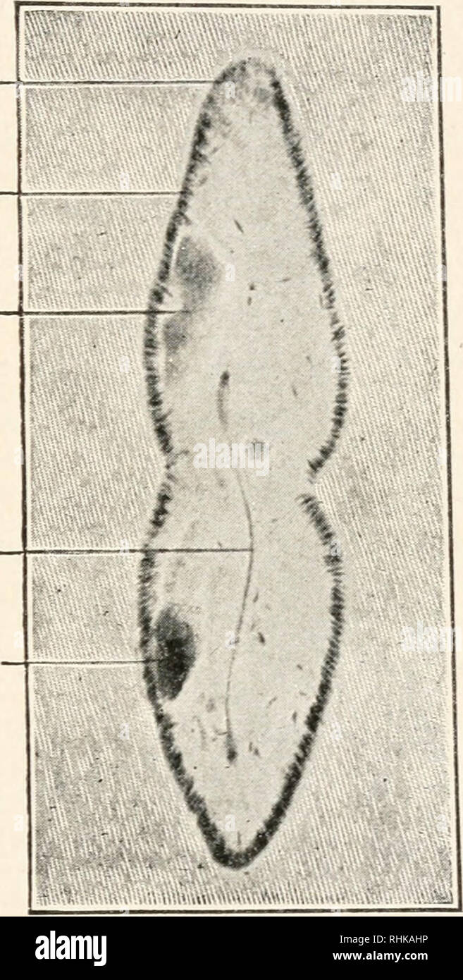 Ciliary action hi-res stock photography and images - Alamy