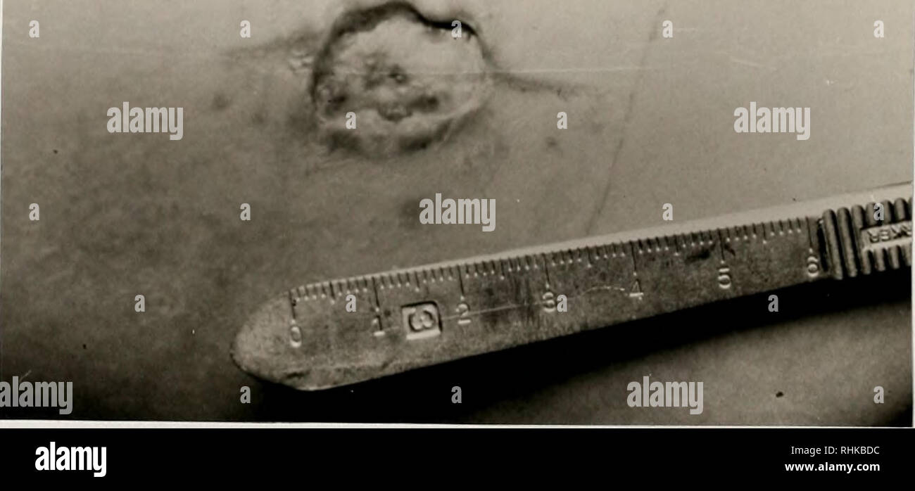 Cutaneous Leishmaniasis High Resolution Stock Photography and Images ...