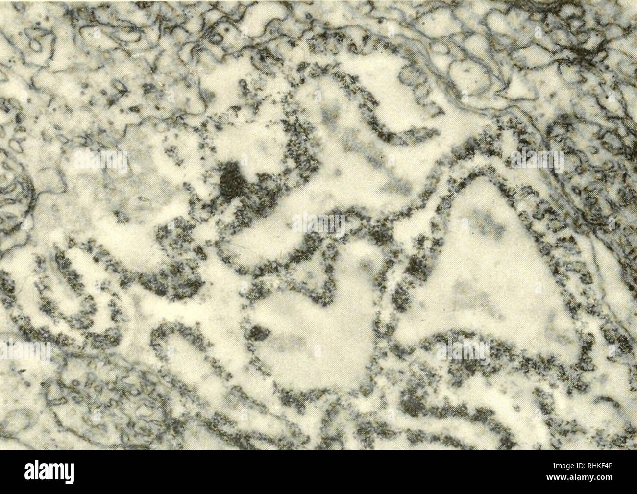 Microvesicles hi-res stock photography and images - Alamy