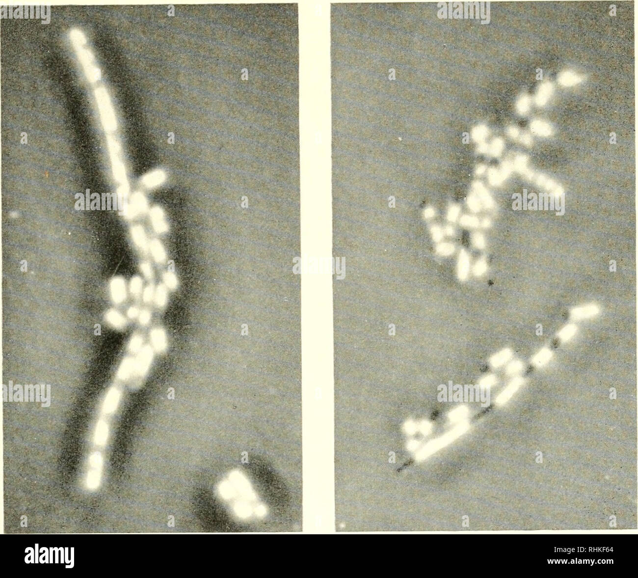 Human serum albumin hi-res stock photography and images - Alamy