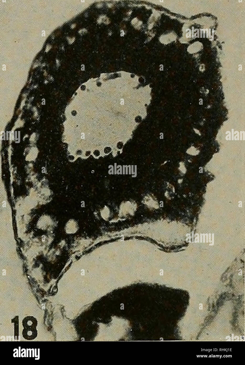 Globulins hi-res stock photography and images - Alamy