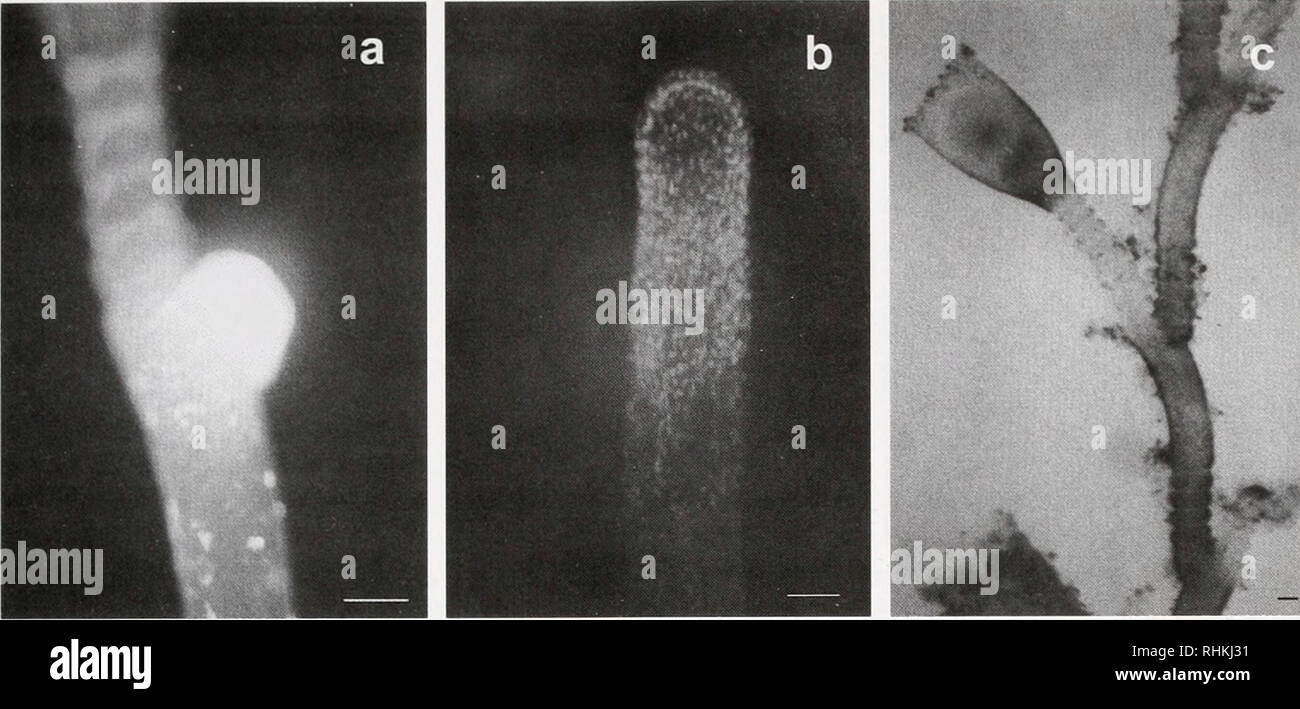 Calcofluor white hi-res stock photography and images - Alamy