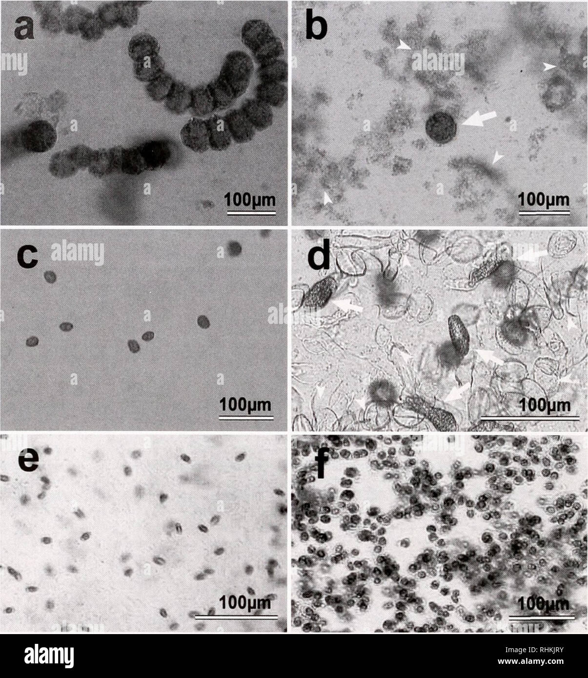 Microalgae cell hi-res stock photography and images - Alamy