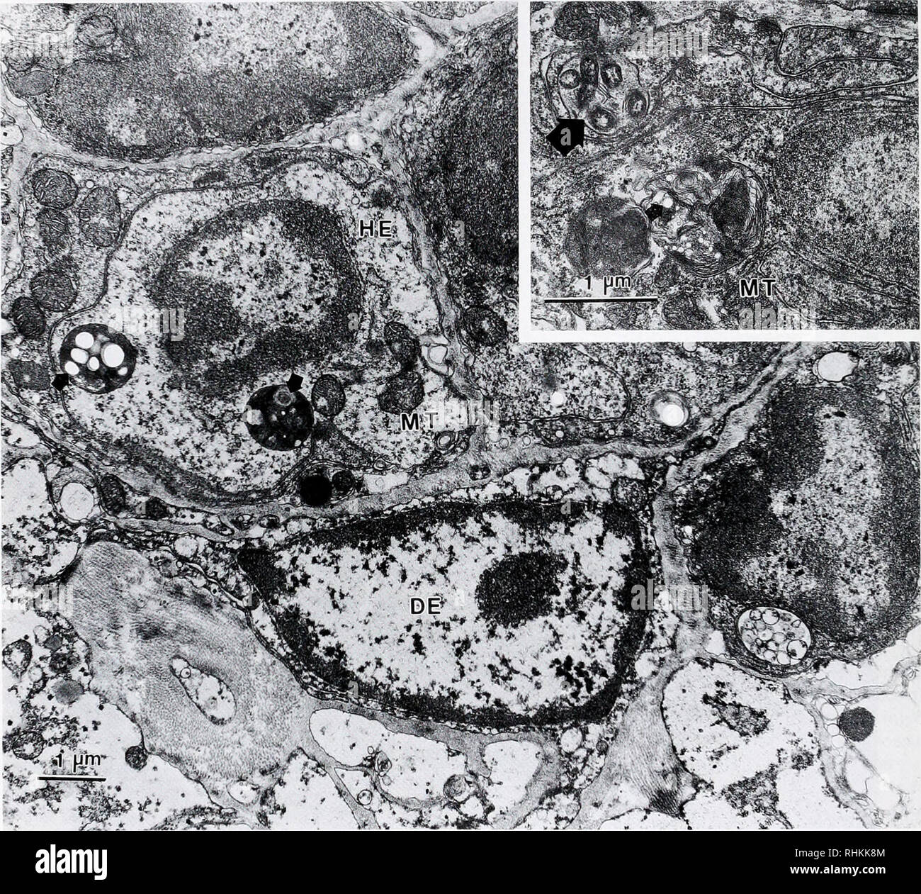 Pyknotic body hi-res stock photography and images - Alamy