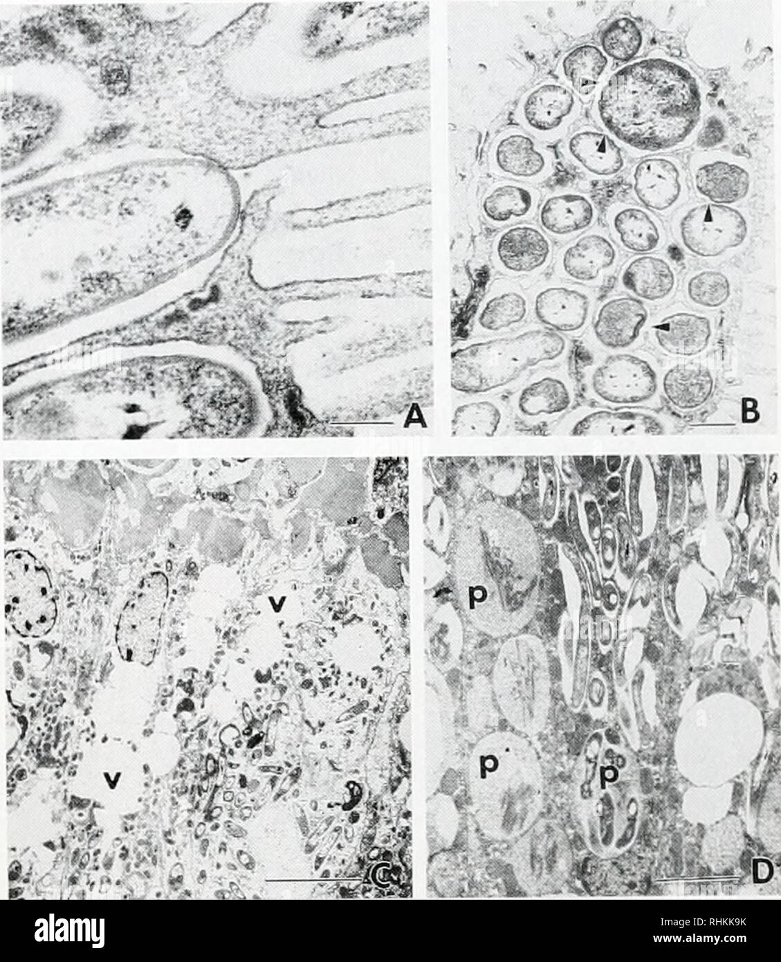Gram negative membrane hi-res stock photography and images - Alamy
