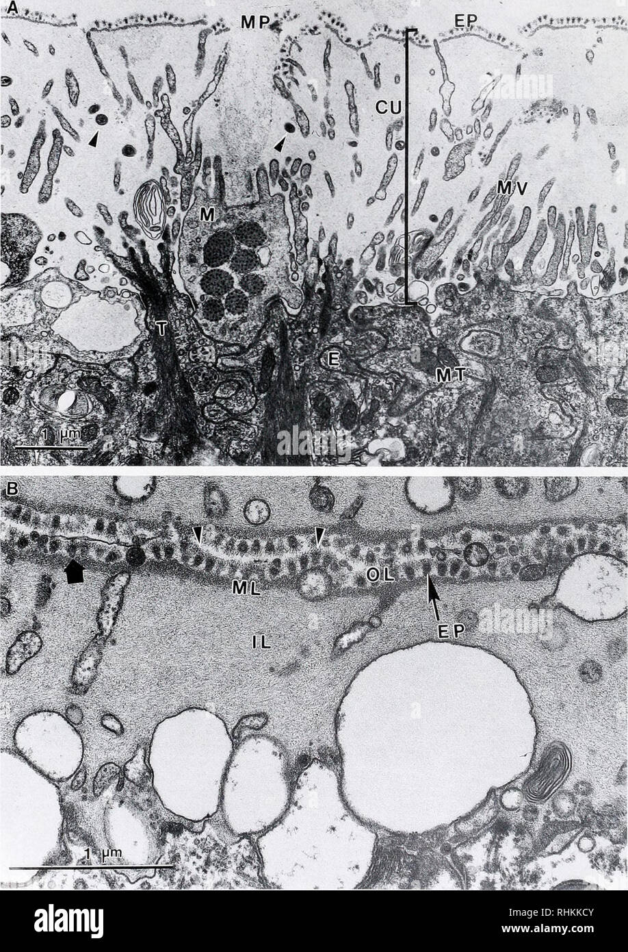 Layer of mucus hi-res stock photography and images - Alamy