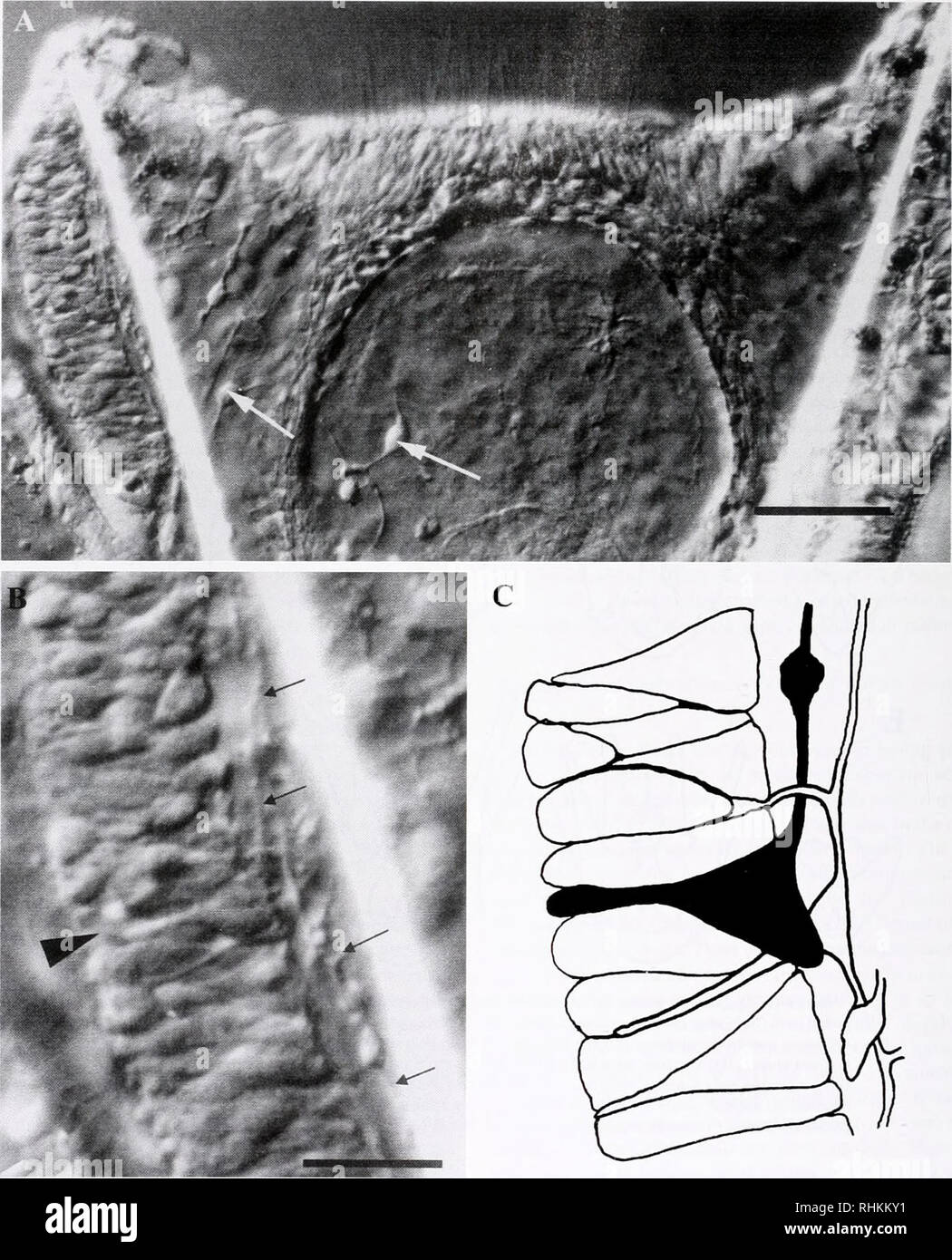 Multipolar neuron diagram hi-res stock photography and images - Alamy