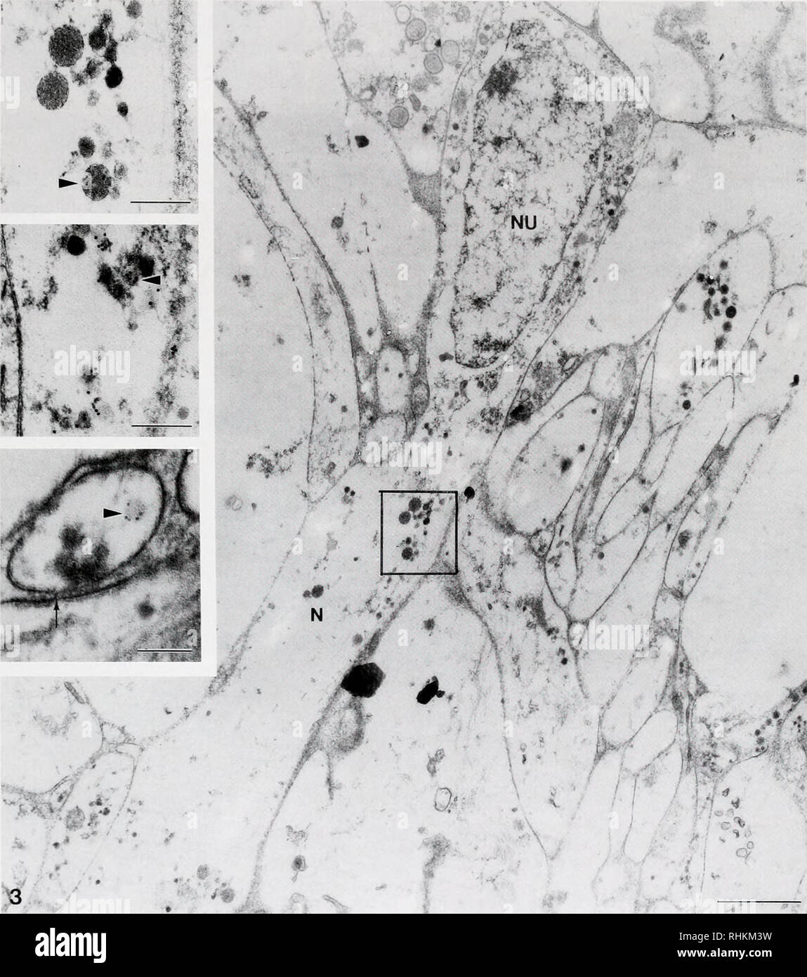 Neuron micrograph hi-res stock photography and images - Alamy