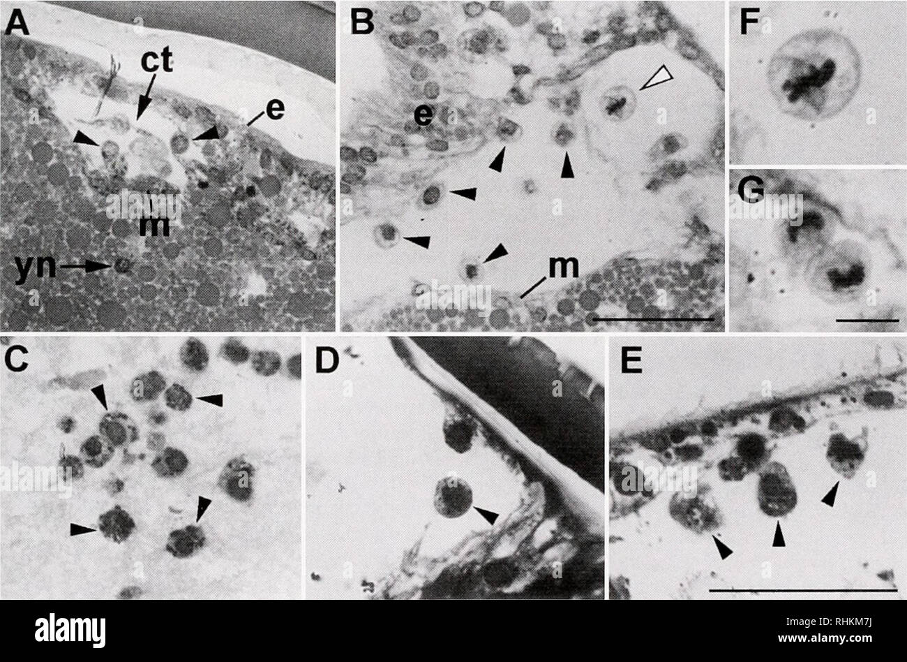 Giemsa stain hi-res stock photography and images - Alamy