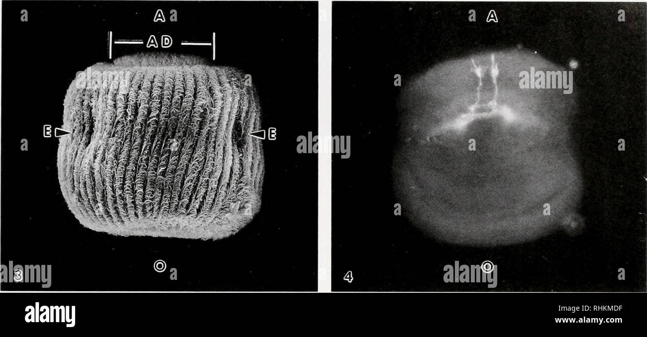 Cilia Electron Micrograph High Resolution Stock Photography and Images ...