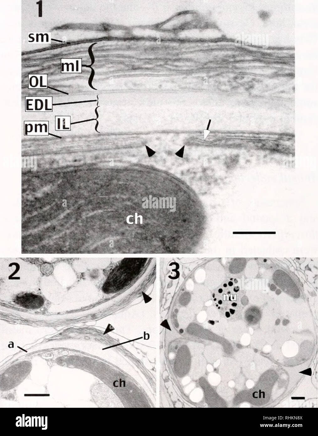 Vesicles electron microscope hi-res stock photography and images - Alamy
