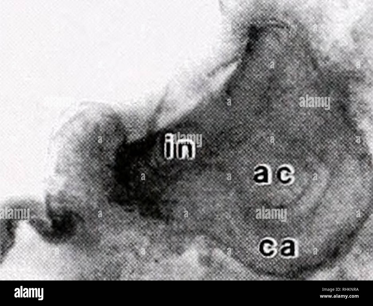 Fluorescent micrograph hi-res stock photography and images - Alamy
