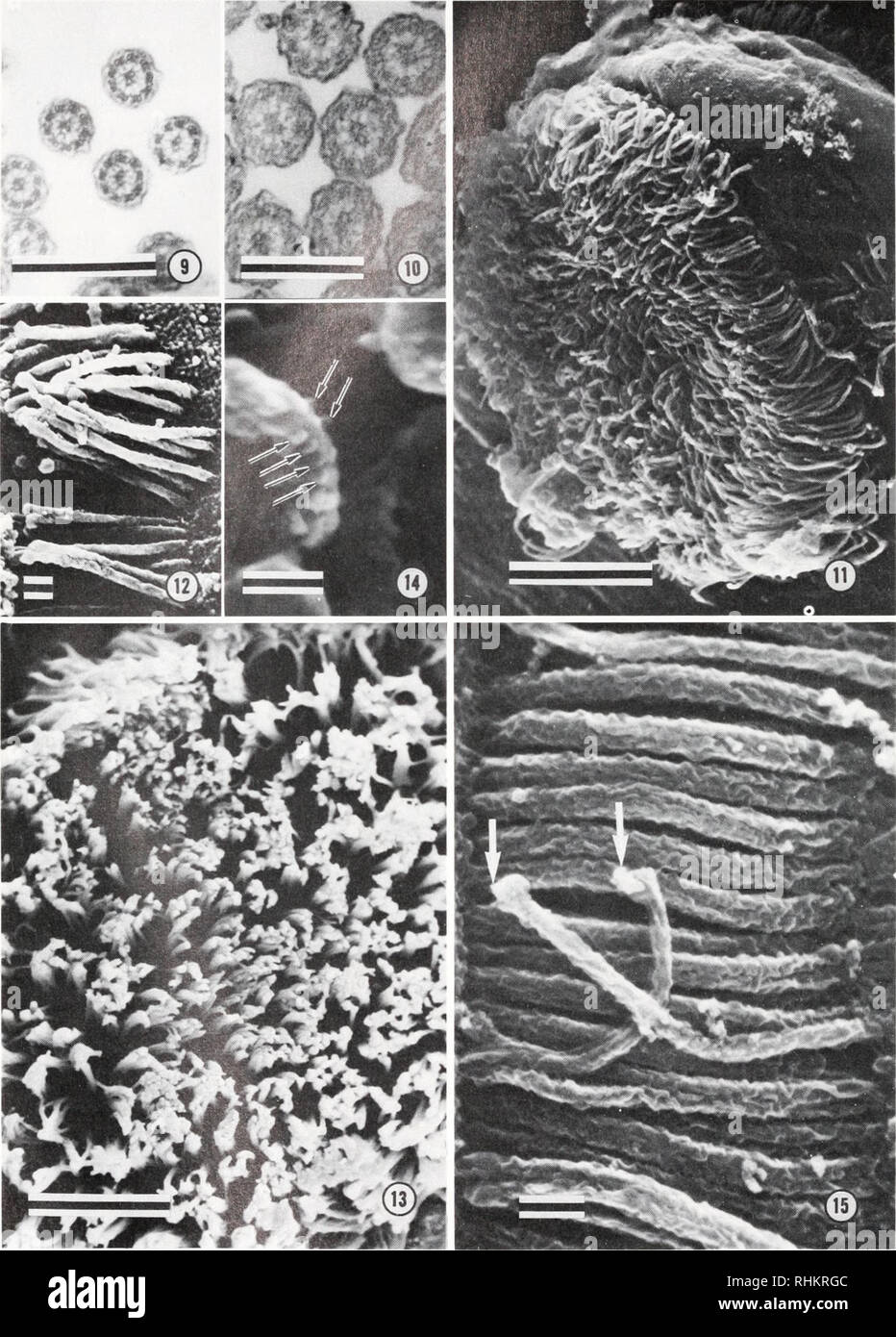 Cilia electron micrograph hi-res stock photography and images - Alamy