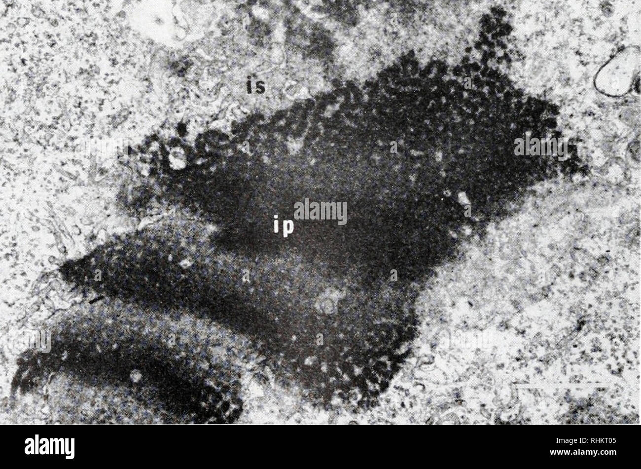 Platelet formation hi-res stock photography and images - Alamy