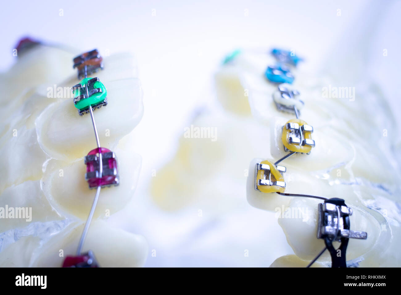 Dental metal braces teeth retainer aligners teaching orthodontics model ...