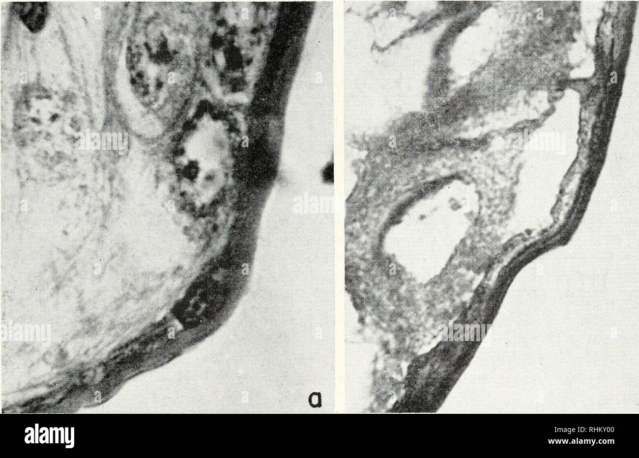 Gomori staining hi-res stock photography and images - Alamy
