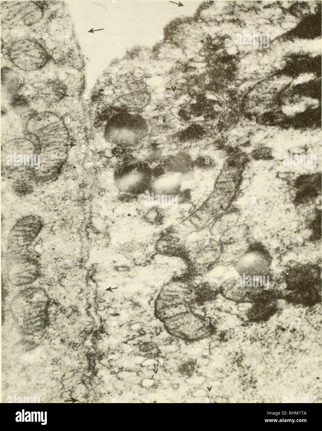 Plasma membrane micrograph hi-res stock photography and images - Alamy