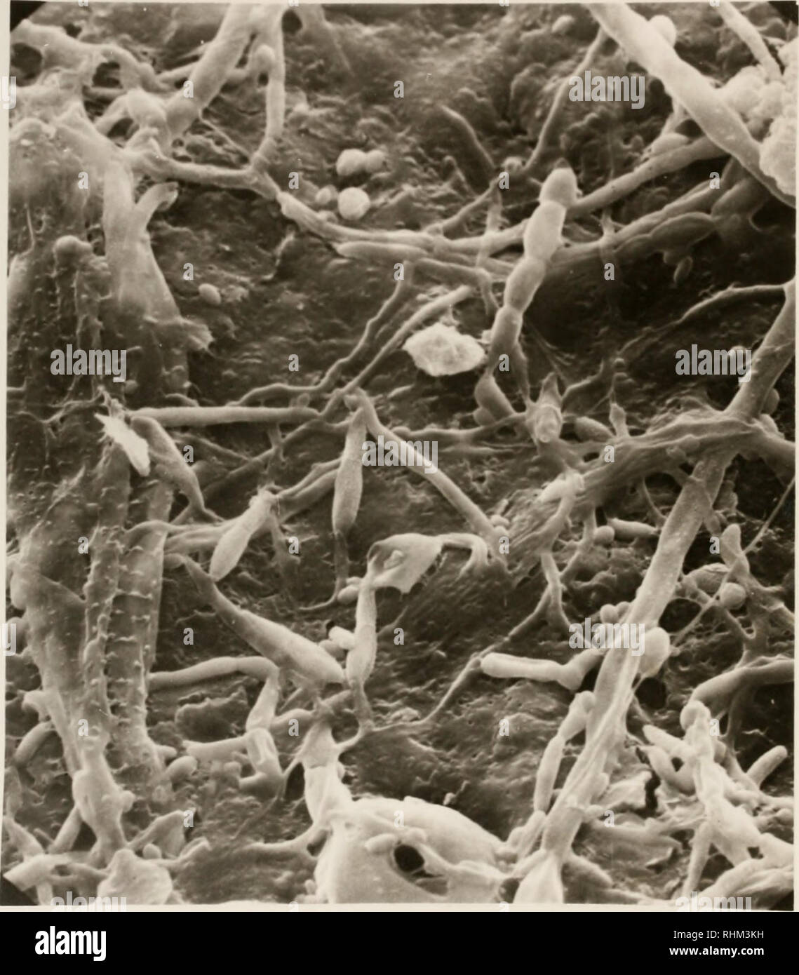 Citrus rust mite phyllocoptruta oleivora hi-res stock photography and ...