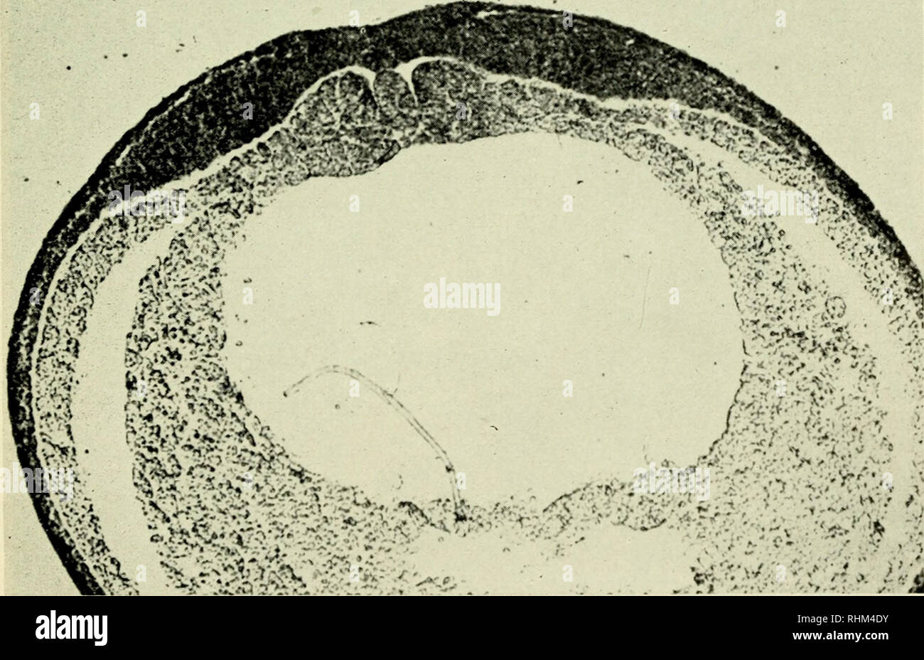 Neurula hi-res stock photography and images - Alamy