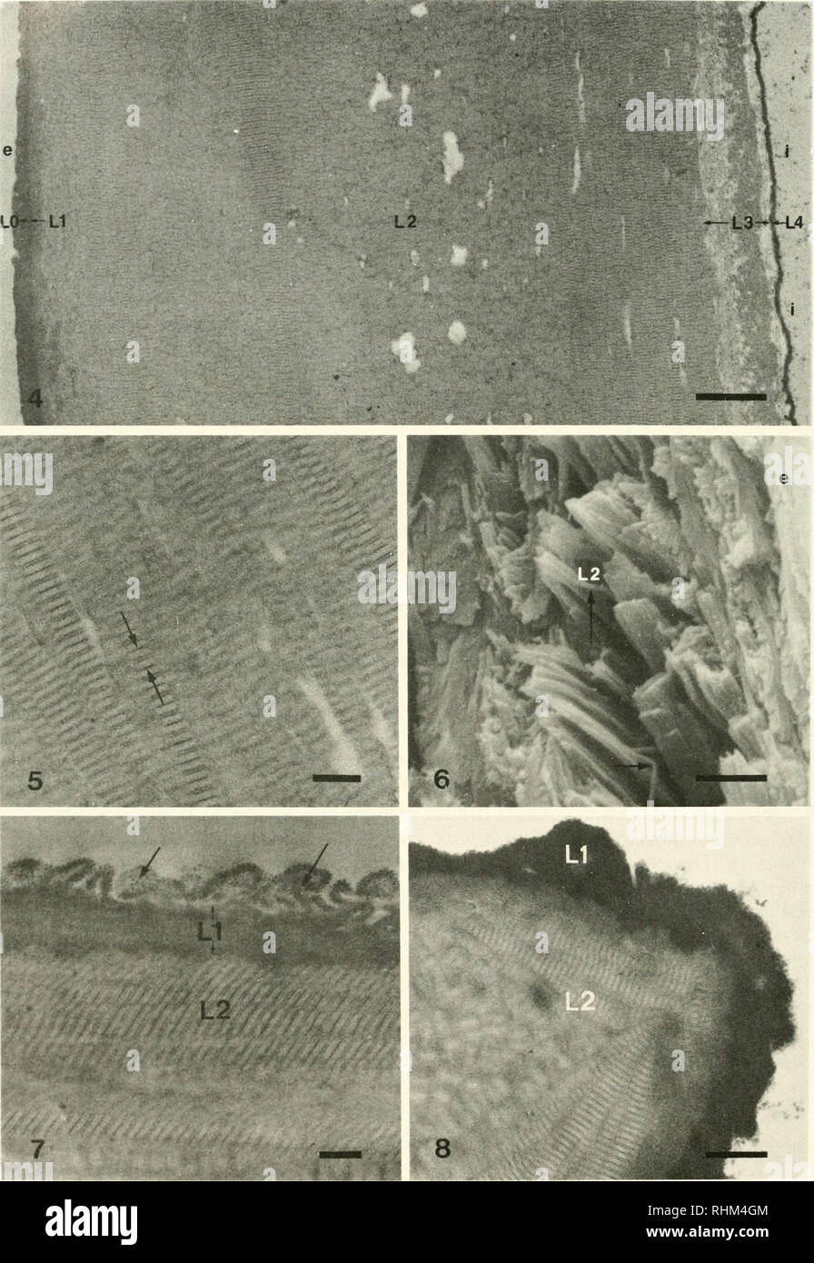 Enhanced transmission electron micrograph hi-res stock photography and ...