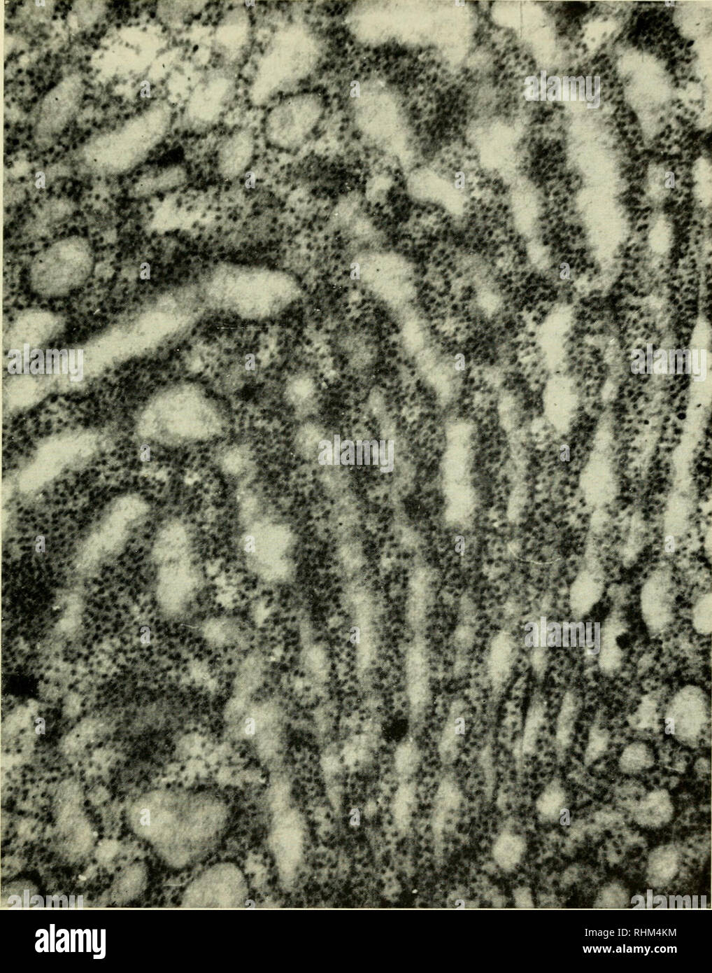 Endoplasmic reticulum micrograph hi-res stock photography and images ...