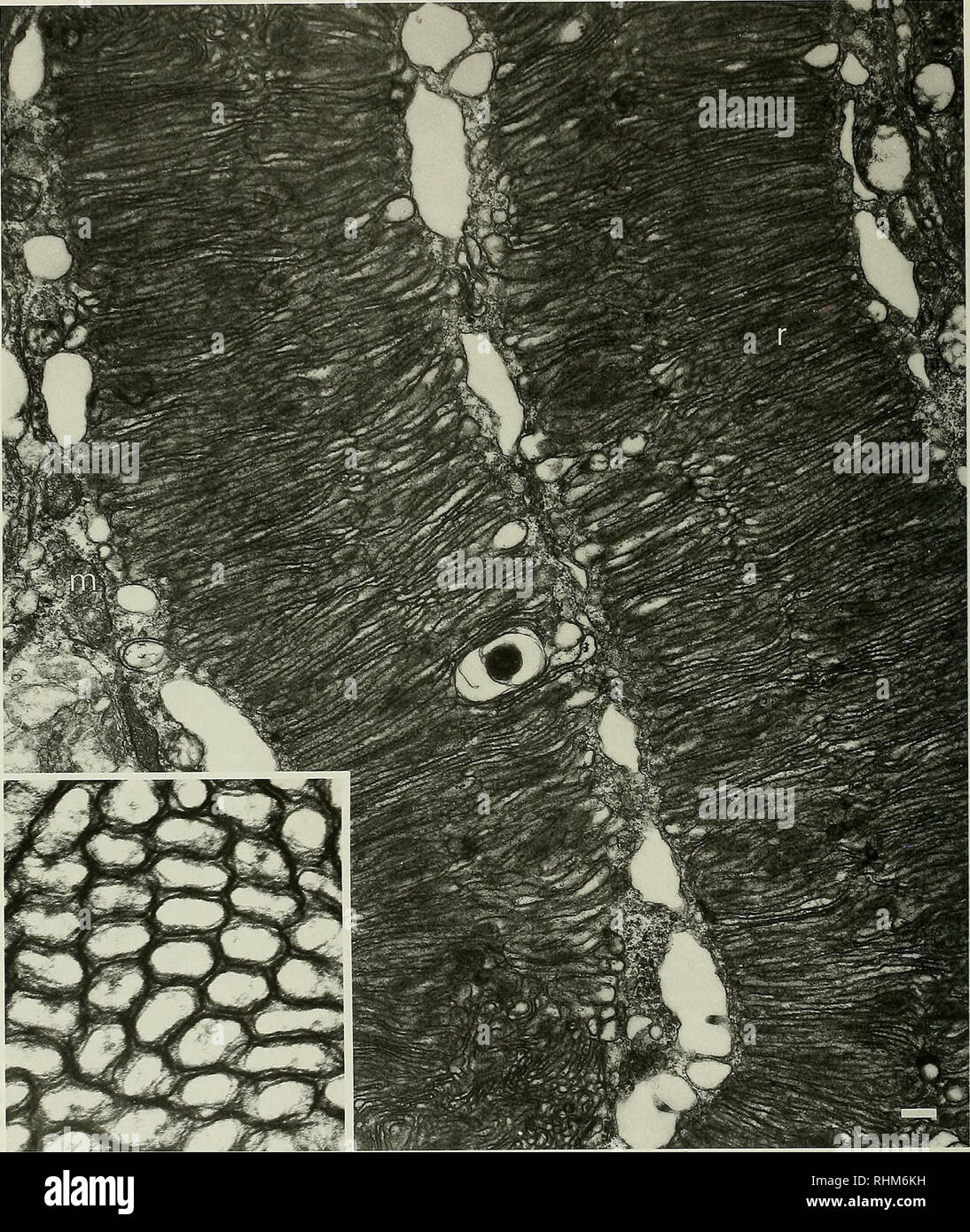 Microvilli electron micrograph hi-res stock photography and images - Alamy