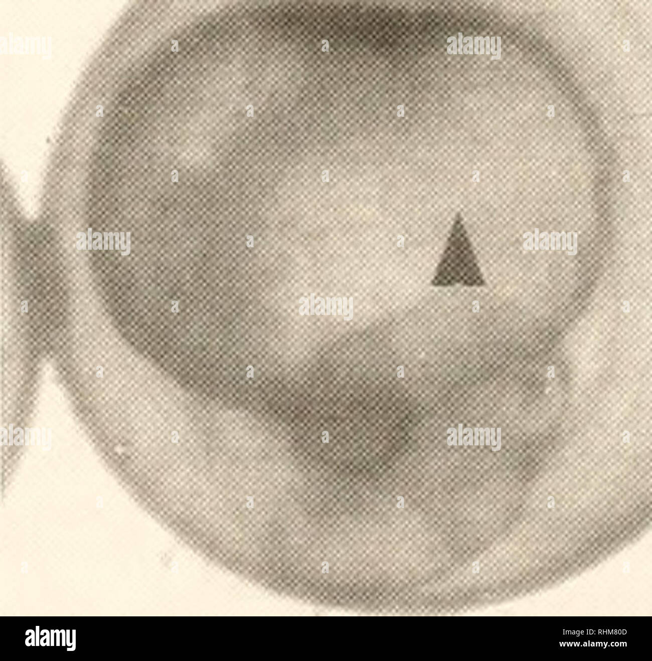 28 day embryo hi-res stock photography and images - Alamy