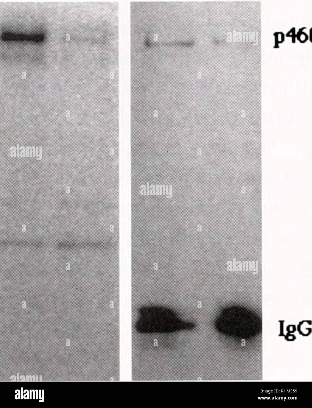 Sea urchin lytechinus pictus hi-res stock photography and images - Alamy