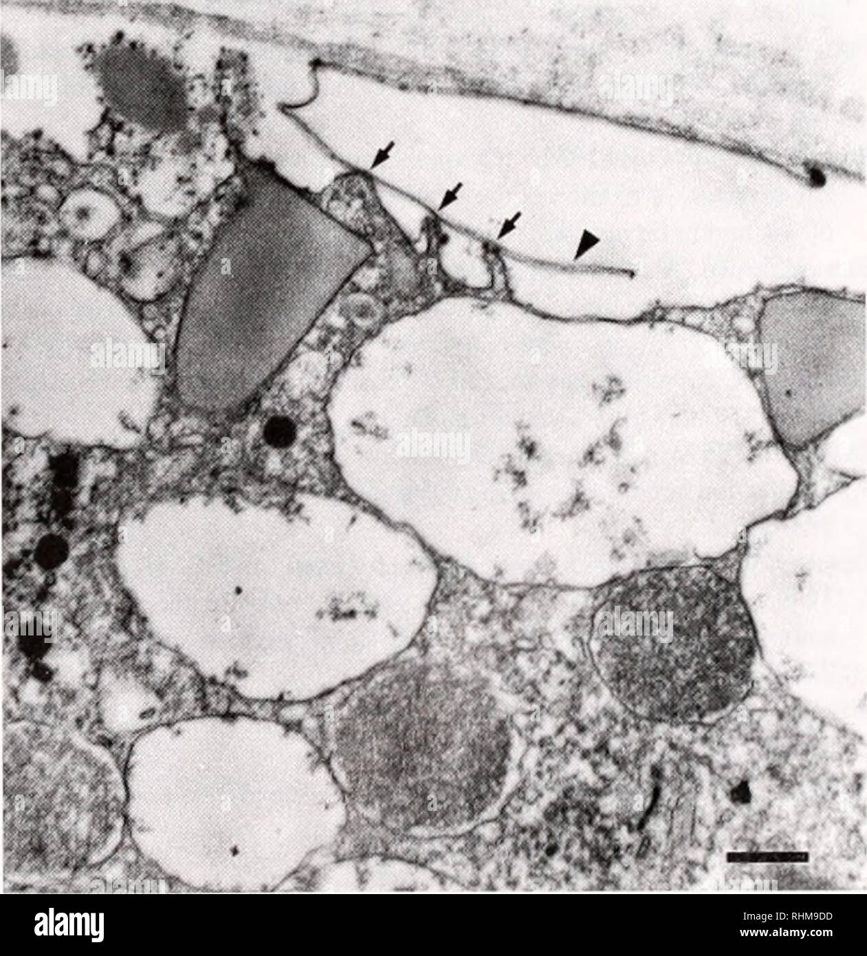 Immune electron microscopy hi-res stock photography and images - Alamy