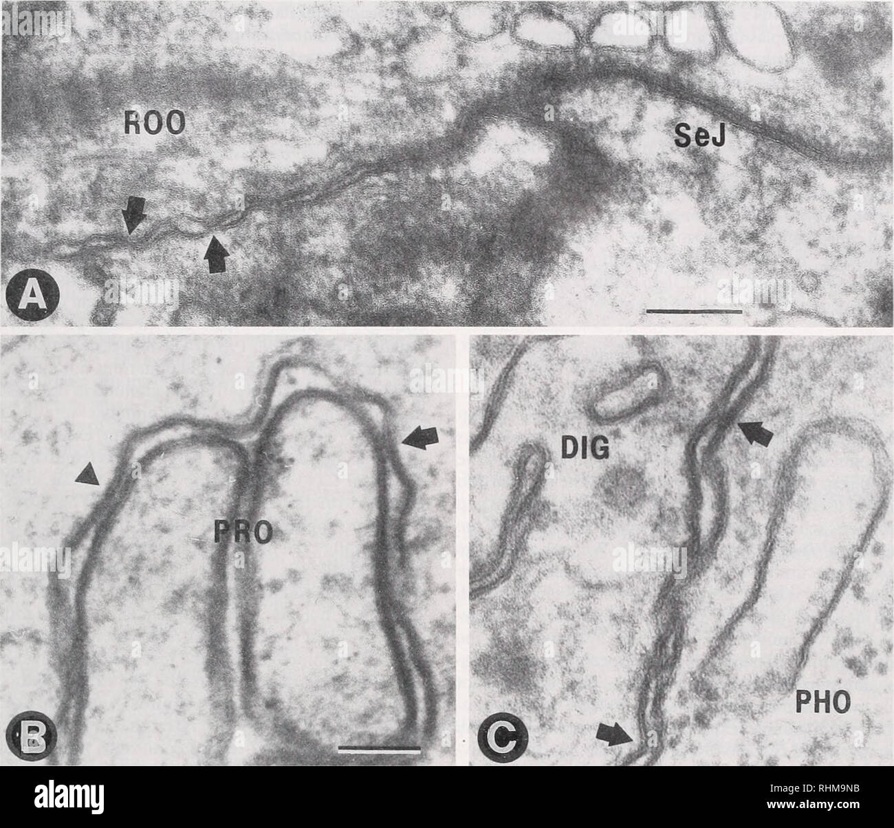 Gap Junction Electron Micrograph