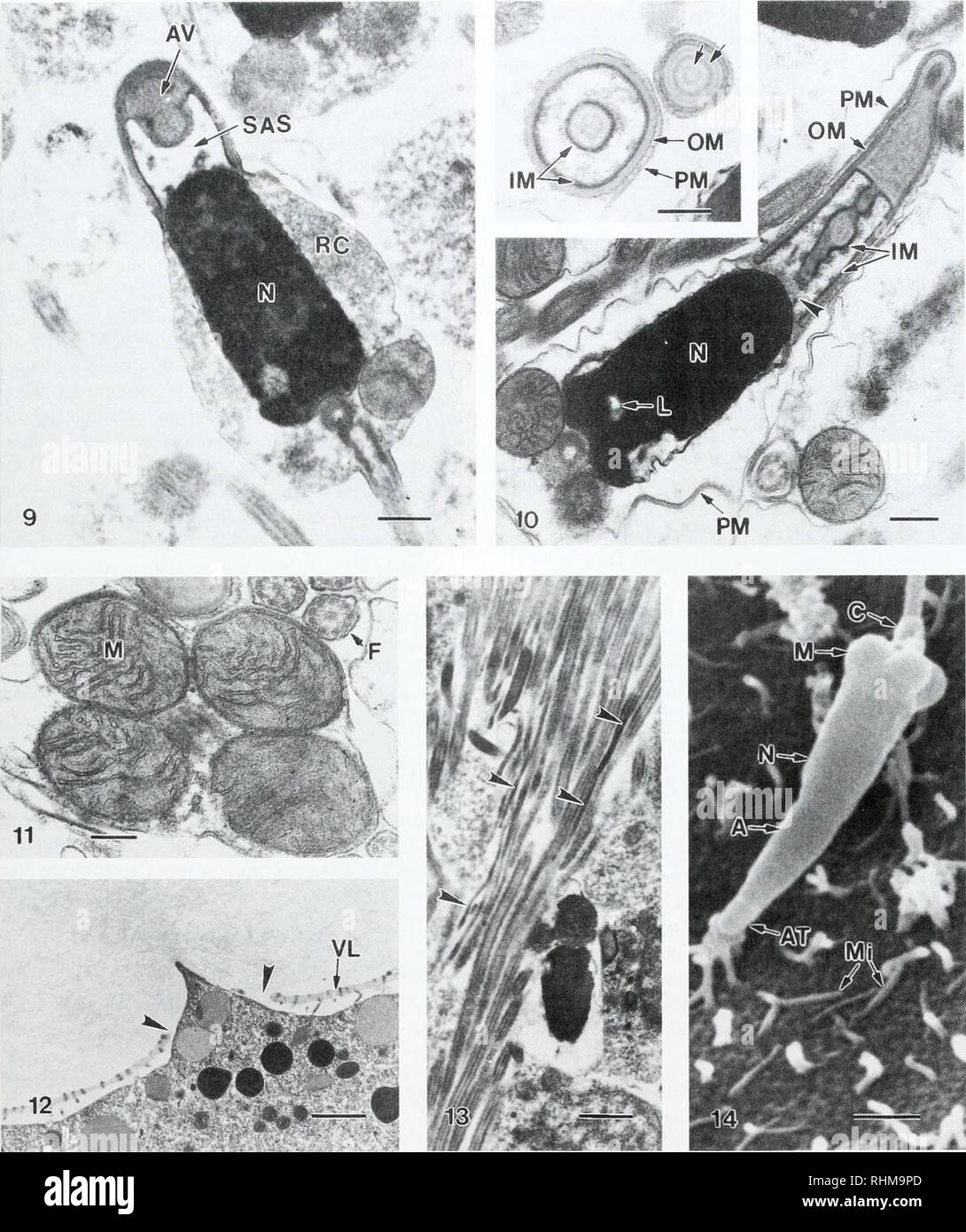 Acrosomal membranes hi-res stock photography and images - Alamy