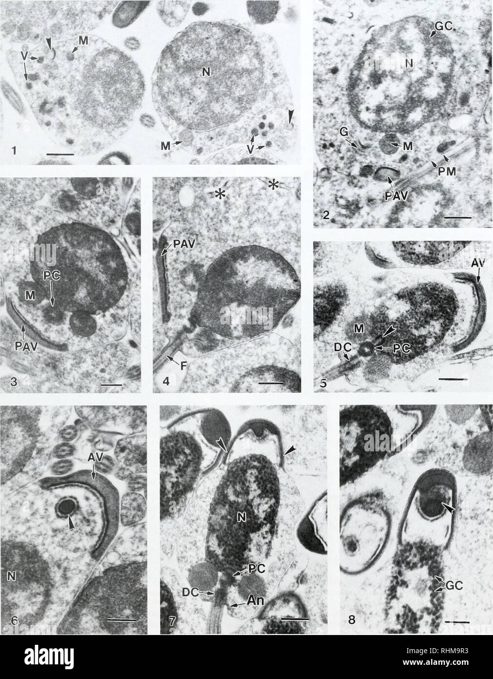 Vesicles In A Cell Micrograph
