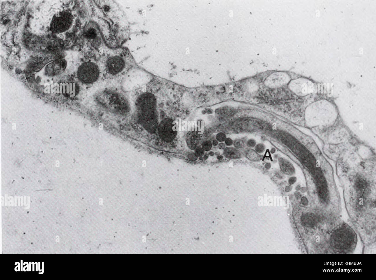 Cell nucleus tem hi-res stock photography and images - Alamy