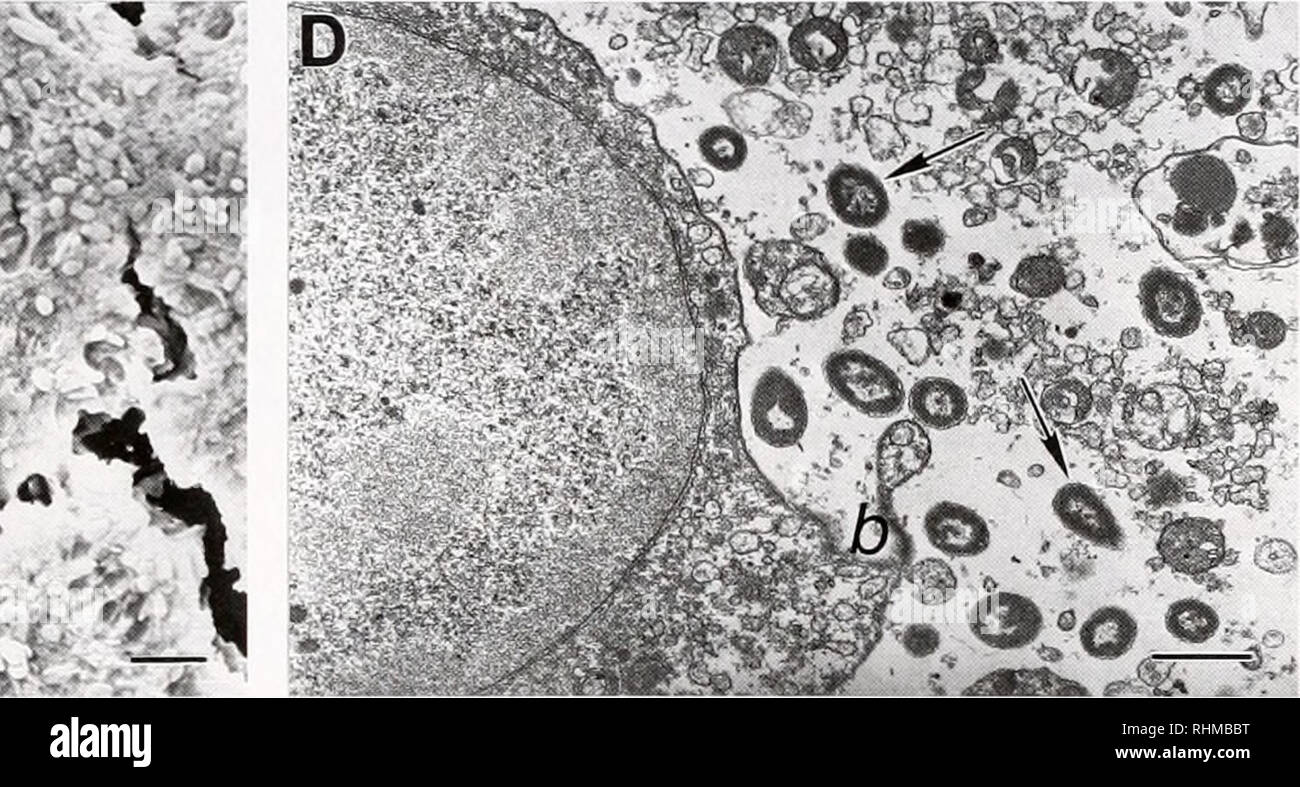 Membrane ruffling hi-res stock photography and images - Alamy